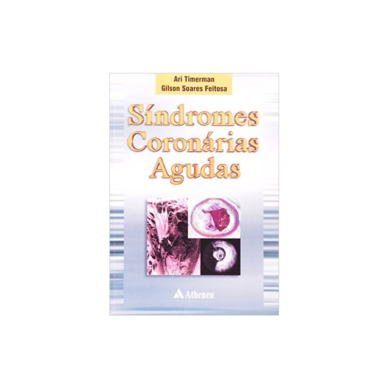 Home Medicina Cardiologia